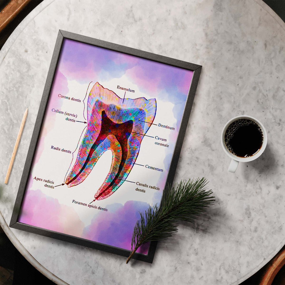 Tooth Anatomy Watercolor - Framed Art Poster For Dental Clinics – The Manan